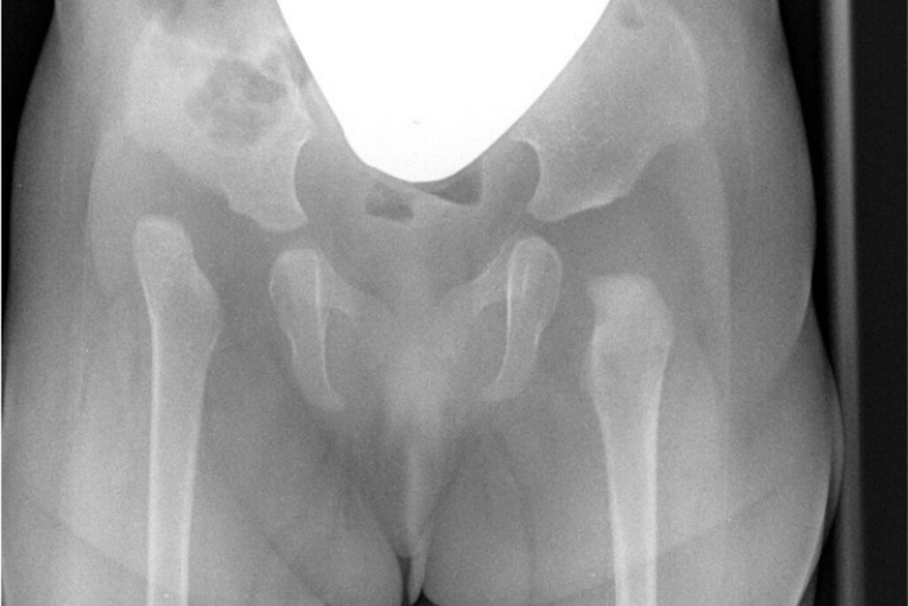 Start - Kinderorthopädie Lübeck